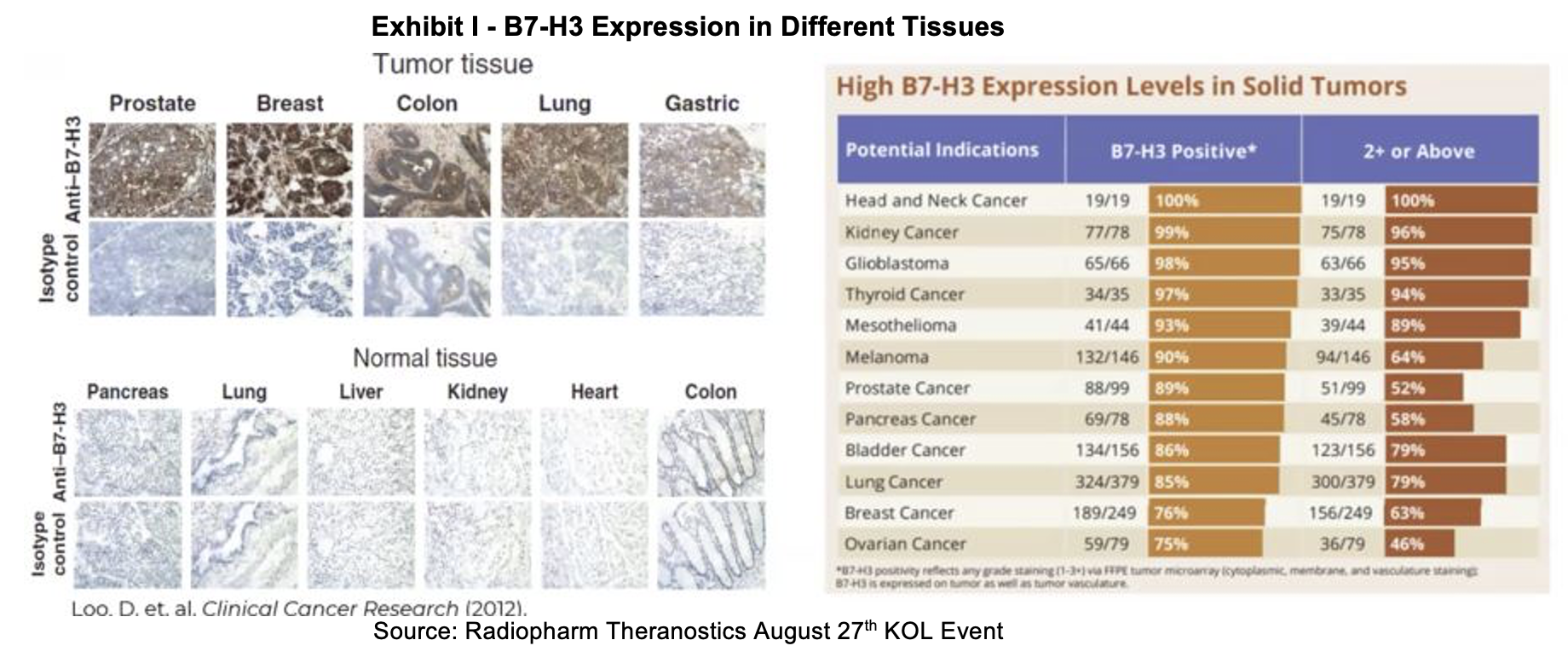 RADX: Prostate Cancer KOL Summary
