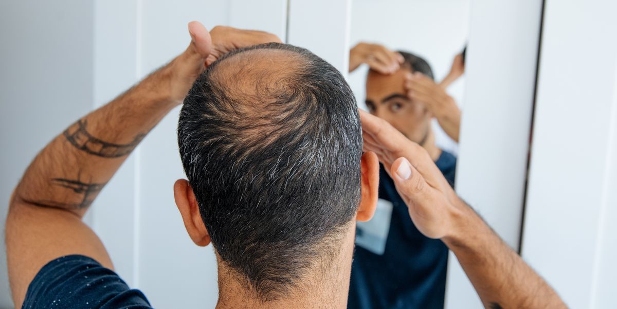 This Breakthrough Drug May Be the Ultimate Baldness Cure. Here's What ...