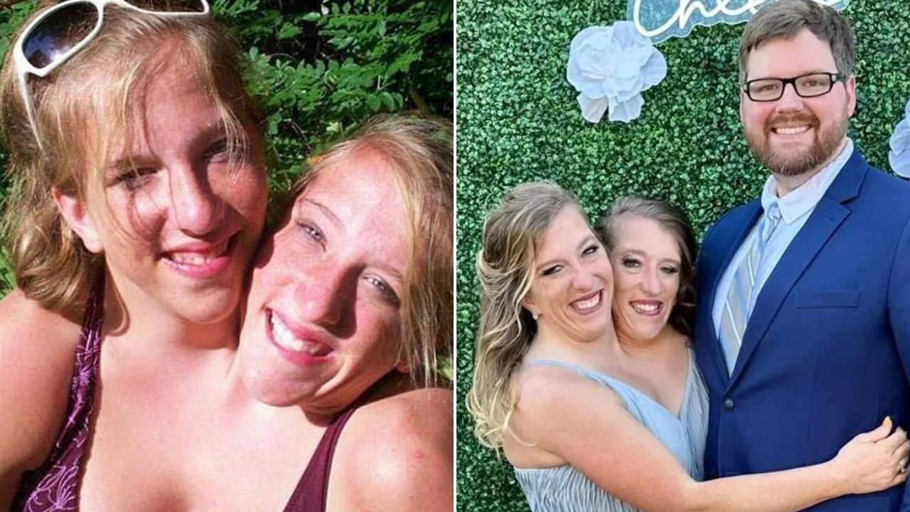 Abby Hensel's Husband Breaks Silence on Conjoined Twins' Alleged TikTok ...
