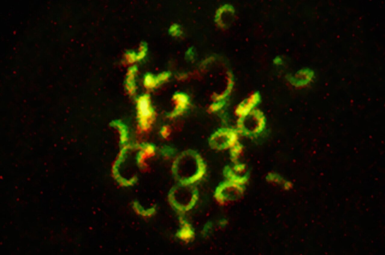 Two routes, one goal: How the crown of cell division is manufactured