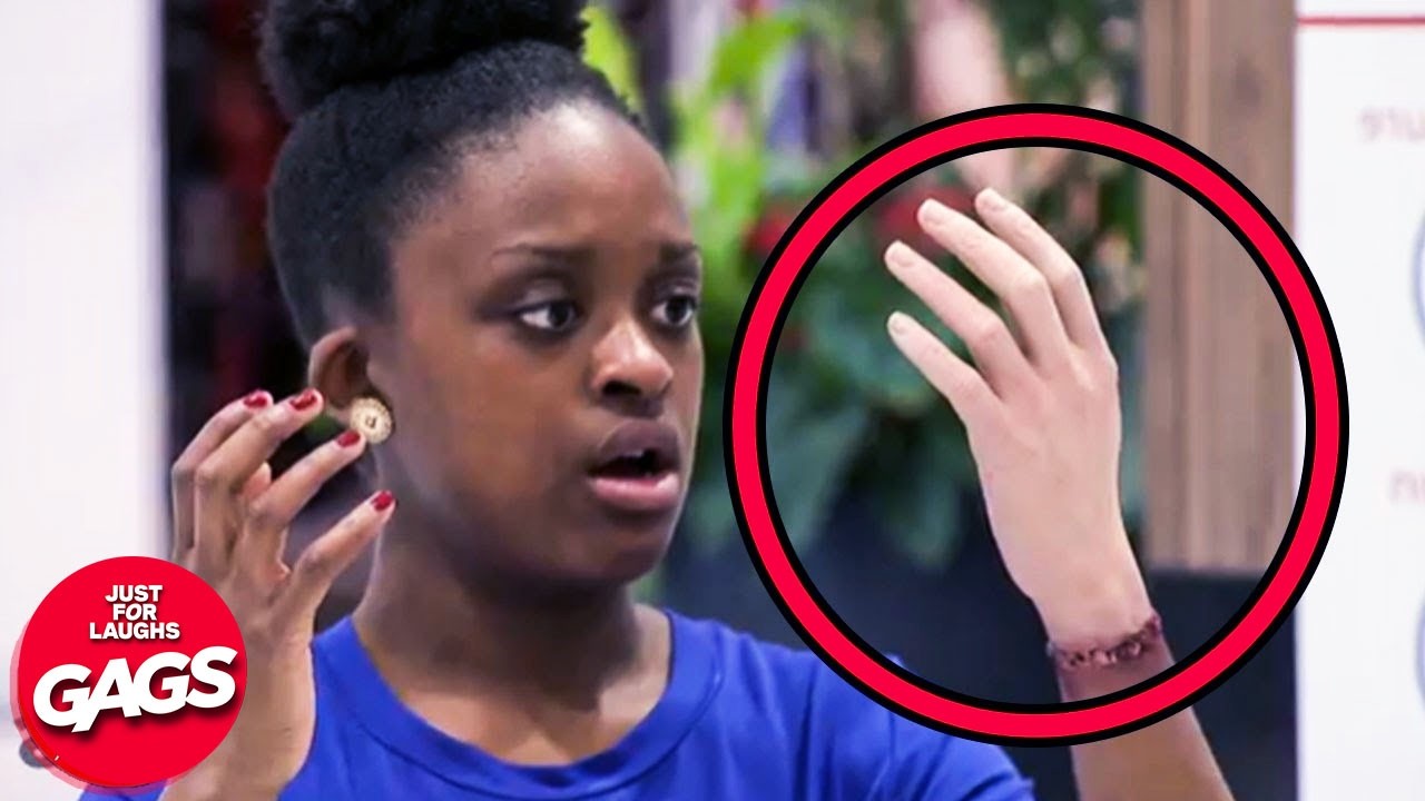 Hand Transplant Goes Wrong… | Just For Laughs Gags