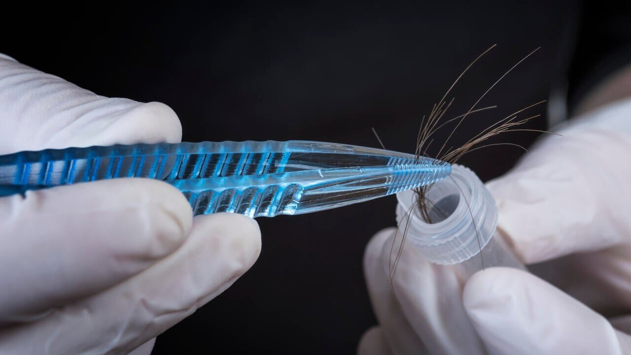 Stress in the strands: Hair offers clues to children's mental health