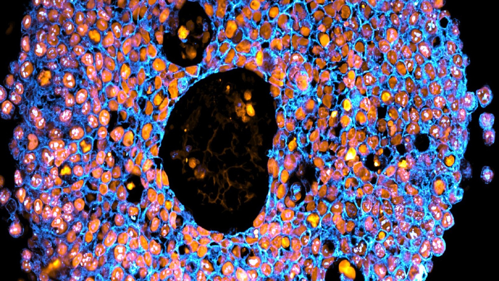World-first 3D placentas print early tissue, test drugs, and reveal ...