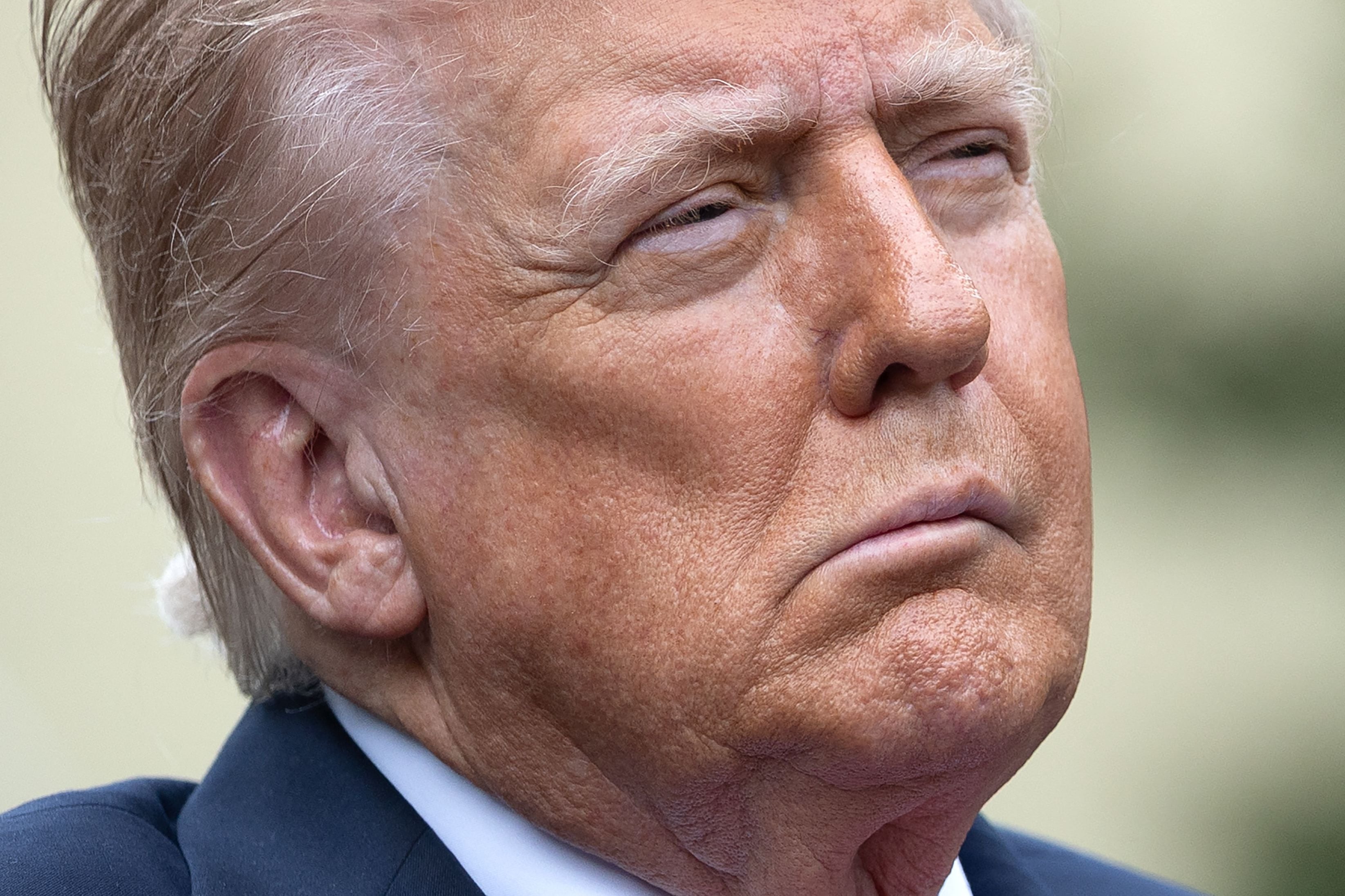 Trump's facial drooping fuels stroke rumors