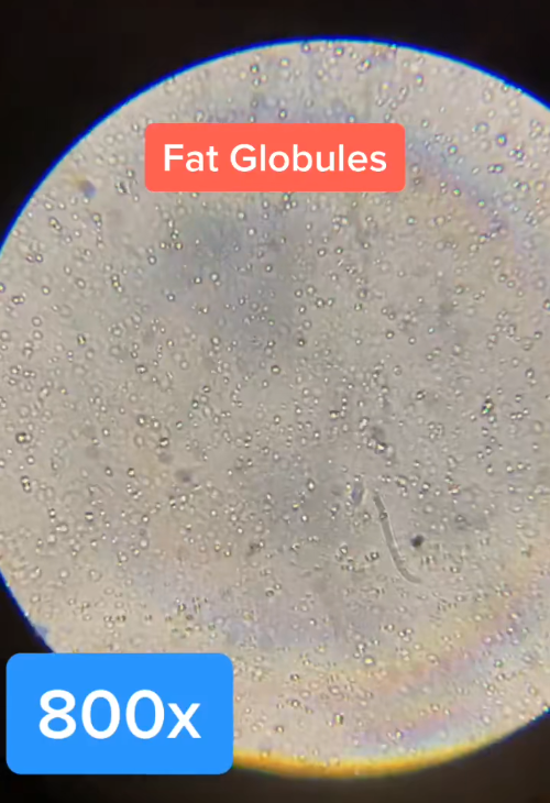 Got Milk? See It Under the Microscope!