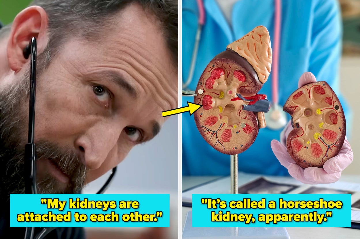 People Are Sharing The “Little Quirks” Their Bodies Have That No One ...