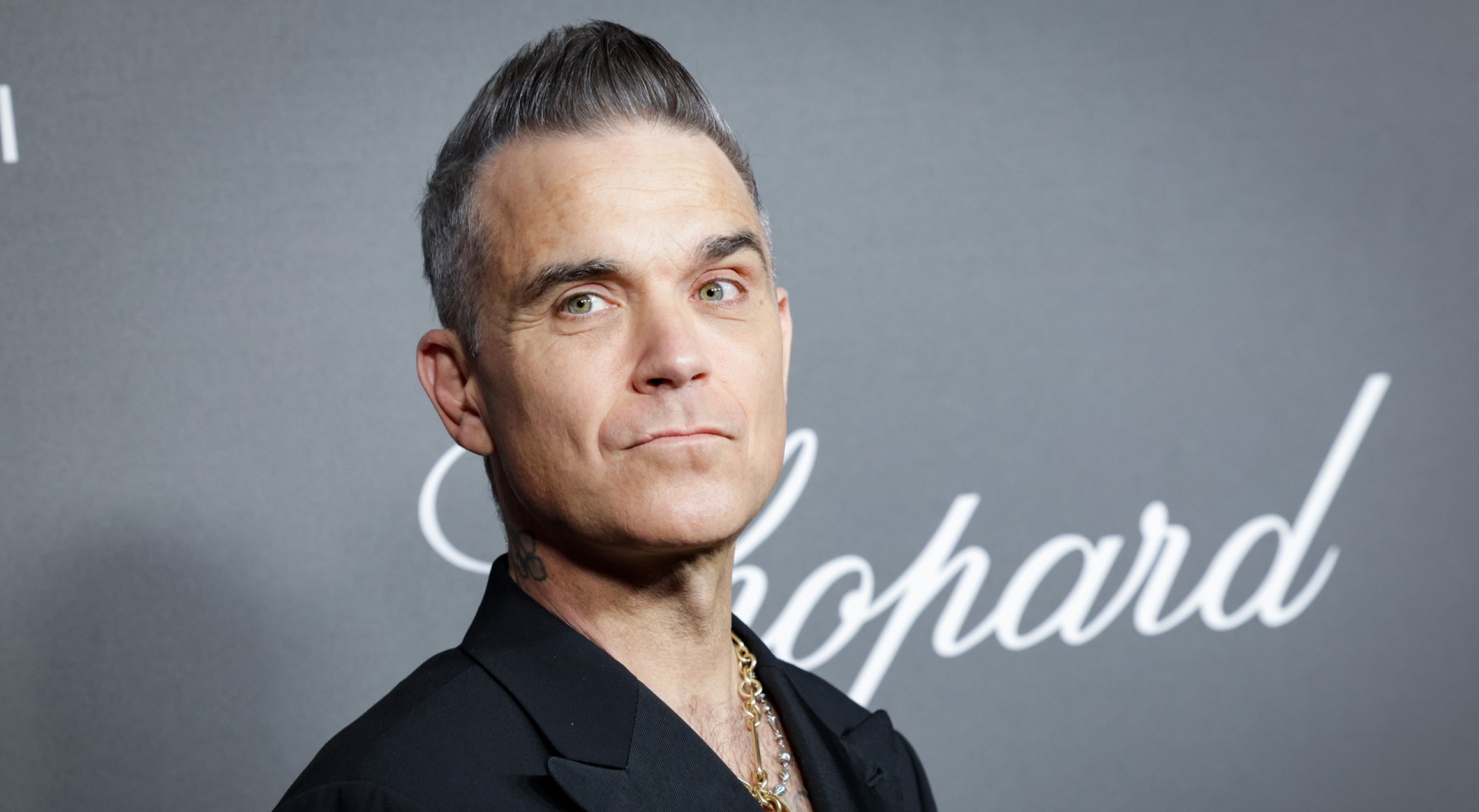 The 17th-century pirate disease Robbie Williams got