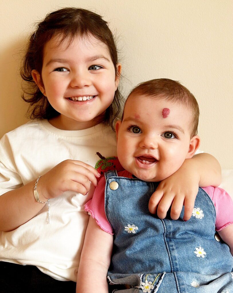 “Strangers mistook my child’s strawberry birthmark for a bumped head”