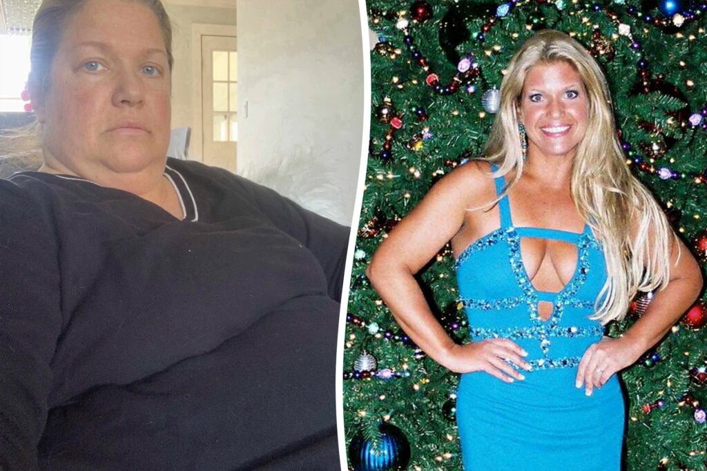 Biggest Loser star unrecognisable after gaining and losing 1,000lbs ...