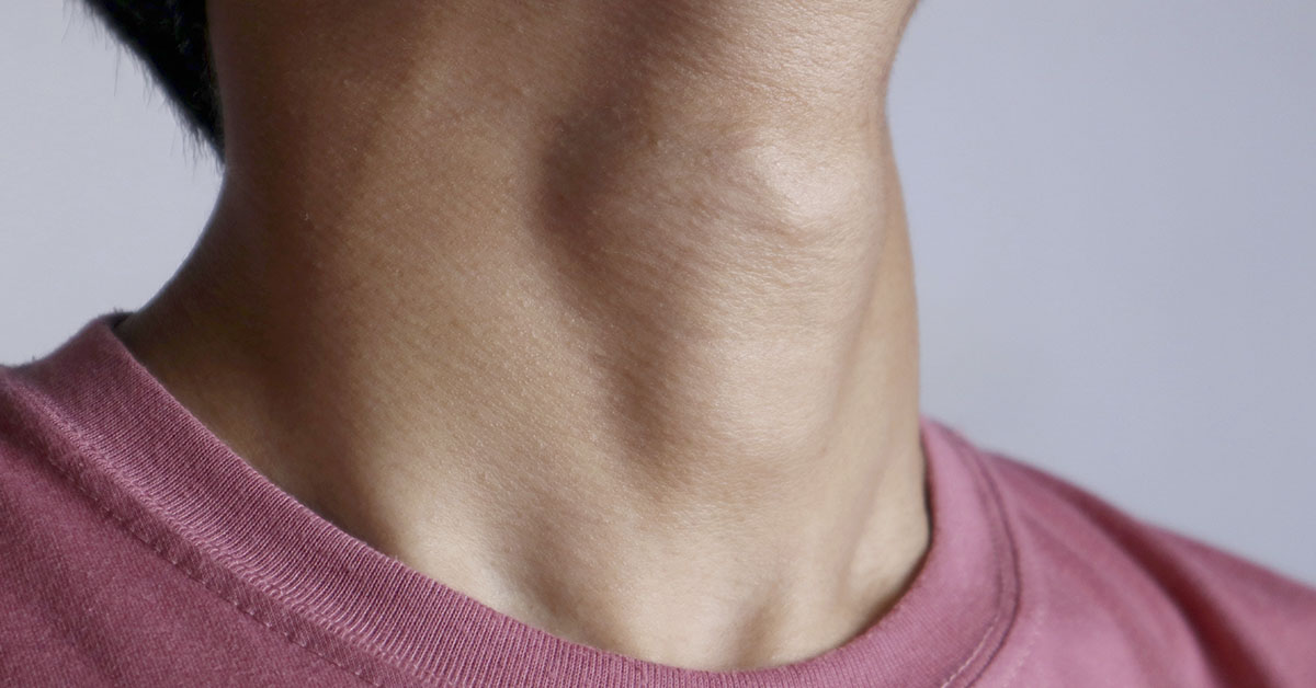 Your Adam's Apple: What is it and Why Does Everyone Has One?