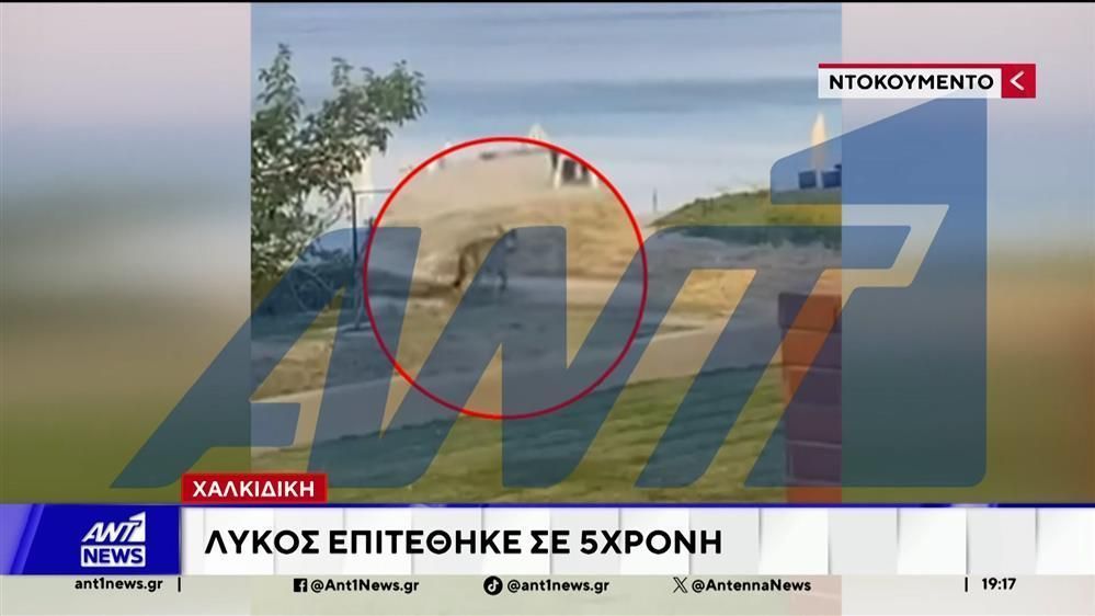 Χαλκιδική: Επίθεση από λύκο δέχθηκε 5χρονη στο Νέο Μαρμαρά