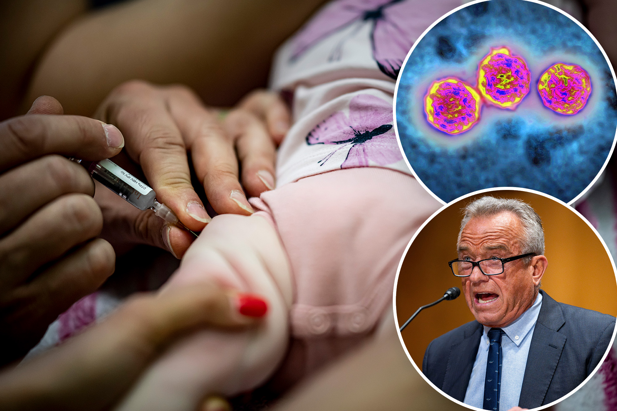 Do babies really need the hepatitis B vaccine? What we know as RFK Jr. moves to delay shots for kids