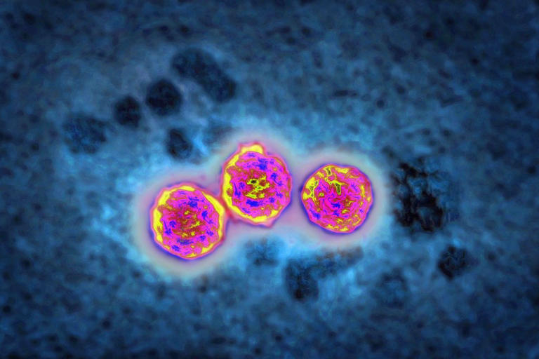 Do babies really need the hepatitis B vaccine? What we know as RFK Jr ...