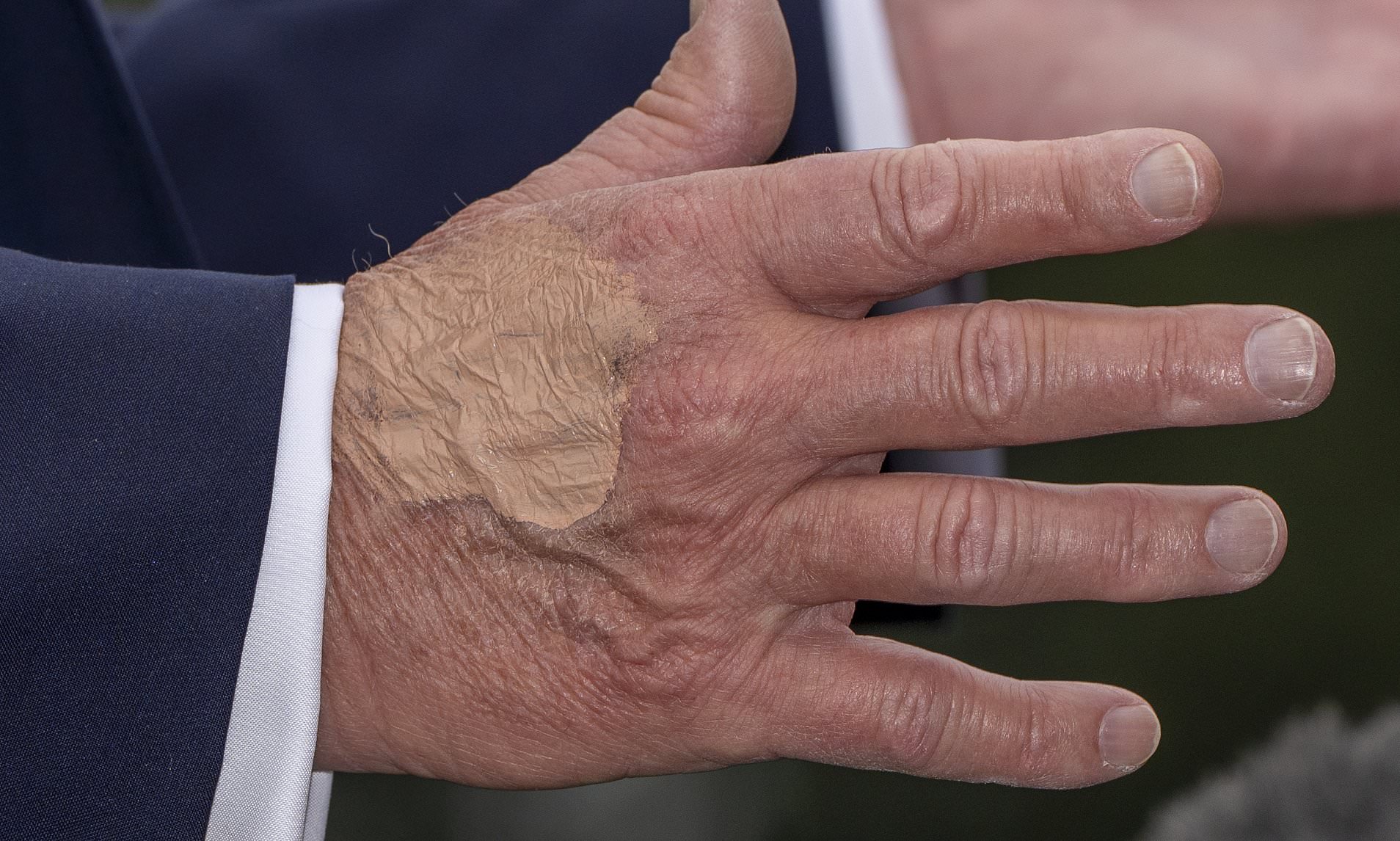 Trump is seen with make-up on his hand ahead of UK visit weeks after he ...