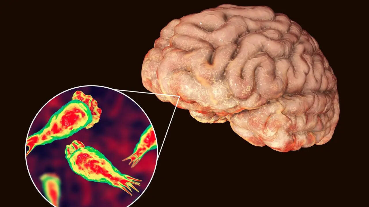 Brain Eating Amoeba Cases Surge In Kerala: All You Need to Know About ...
