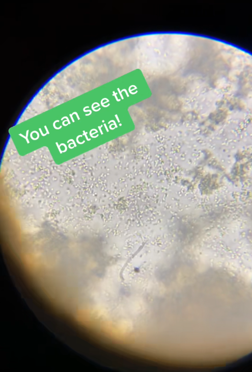Yogurt Like You’ve Never Seen—Under the Microscope!