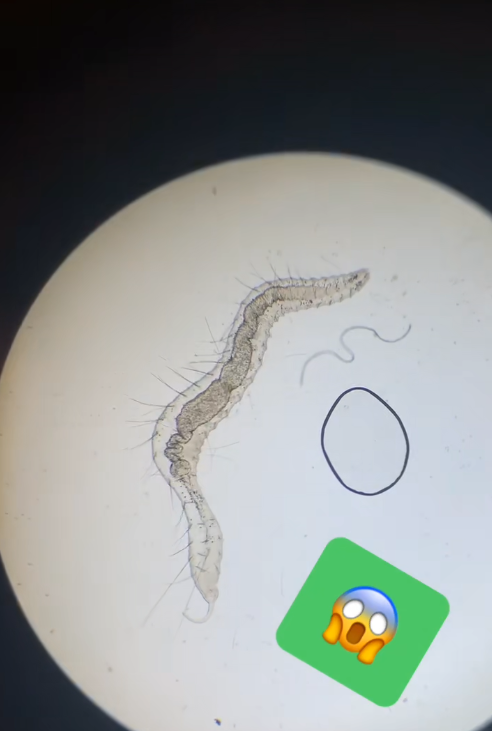 Fish Tank Water Like You’ve Never Seen—Under the Microscope!