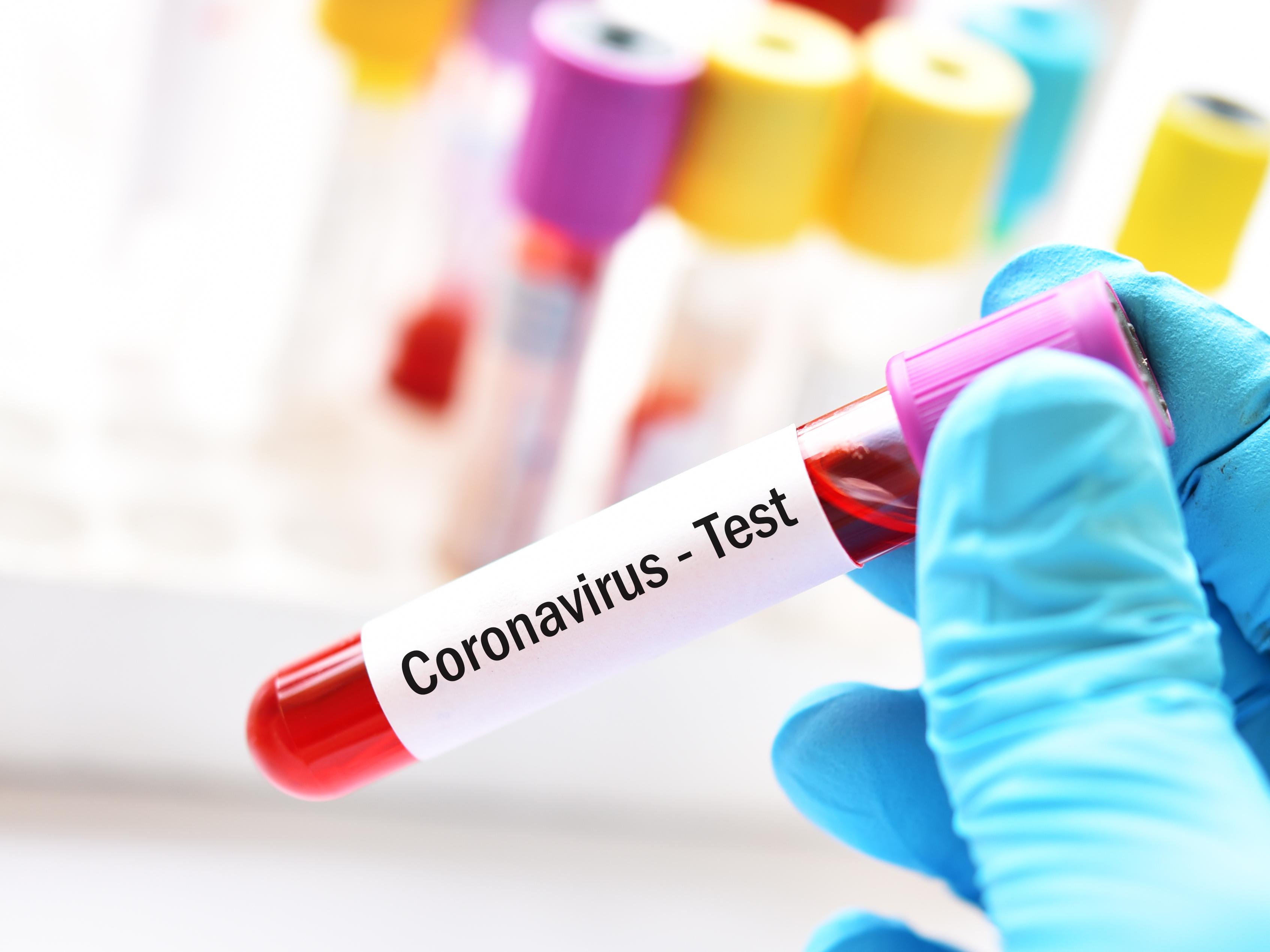 Il caso record di un uomo con Hiv: l'infezione da Covid è durata oltre due anni