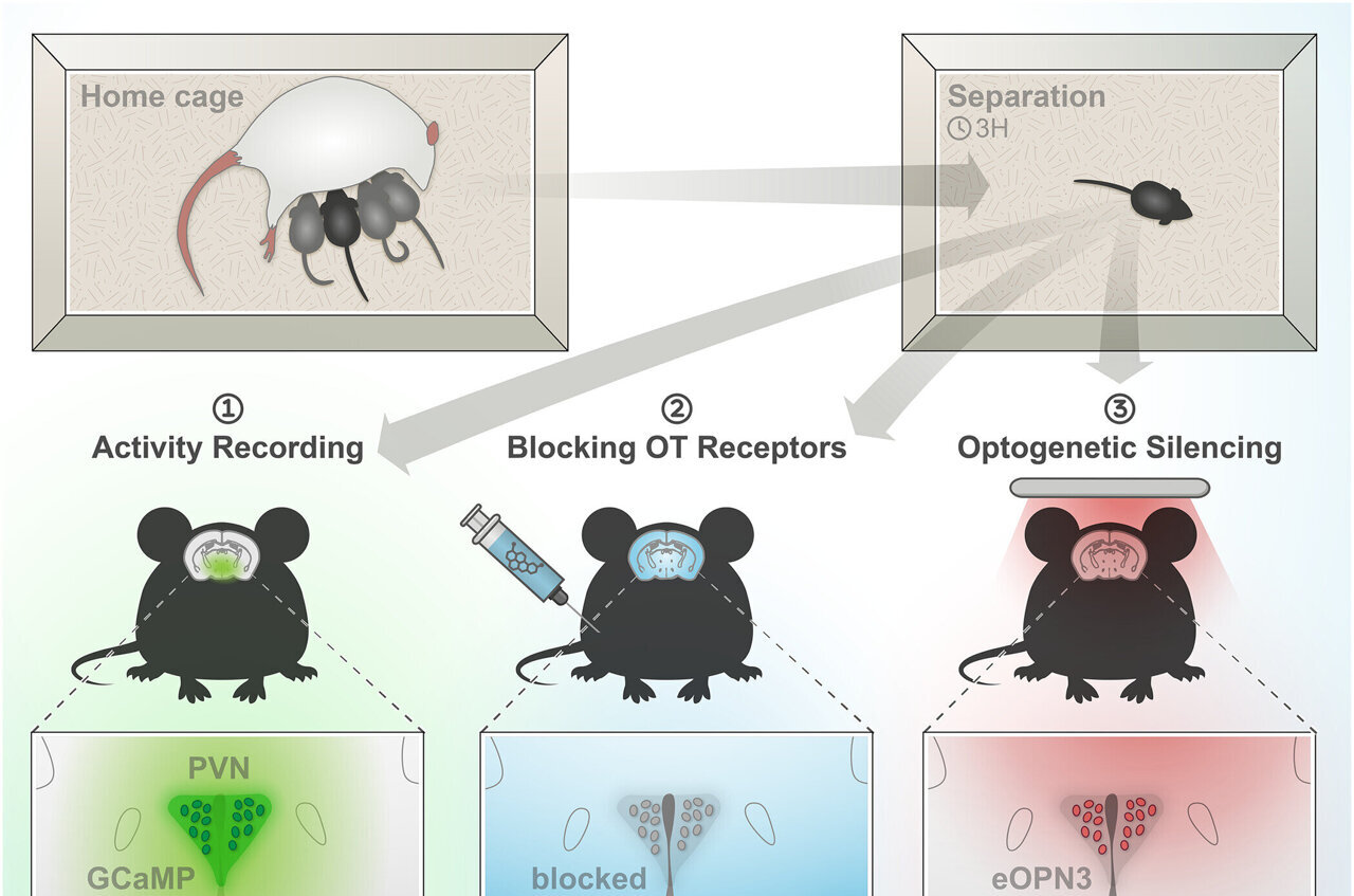 Shining a light on the developing brain: How parental separation shapes us