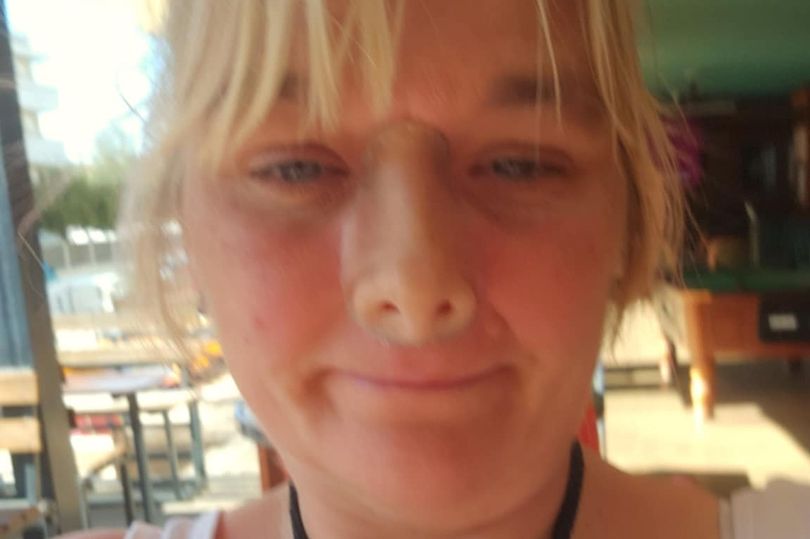 'I thought nosebleeds were hay fever but now my nose has been amputated'