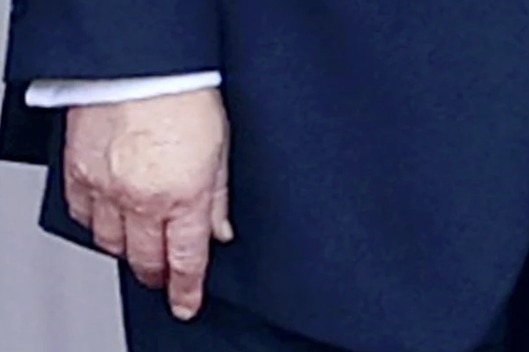 Donald Trump layers hand makeup on for UK visit making no attempt to ...