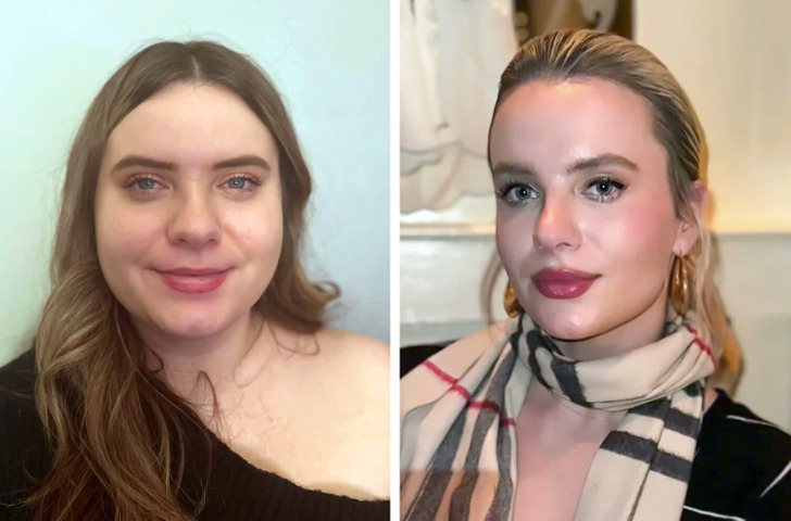 15 People Who Chose Plastic Surgery and Are Totally Obsessed with Their ...