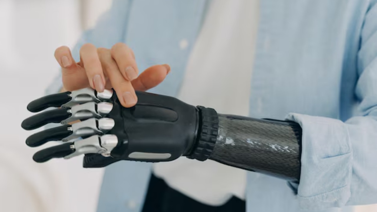 Bionic arms read nerve signals years after amputation