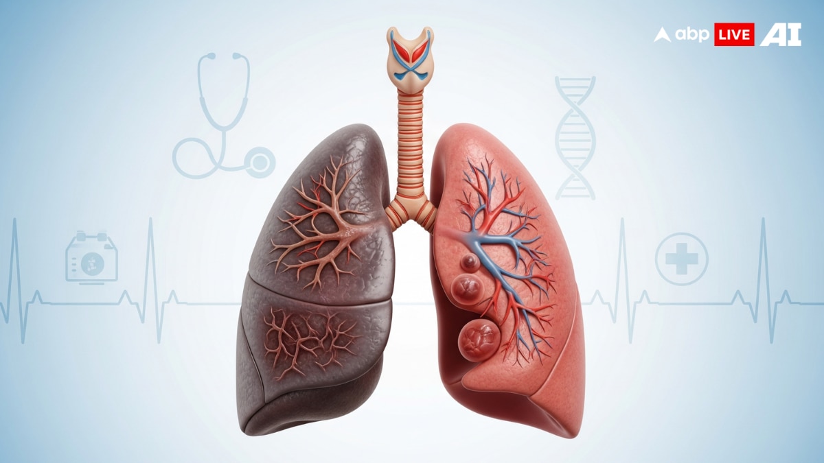 Is Your Shortness Of Breath A Warning Sign? Understanding Early ...