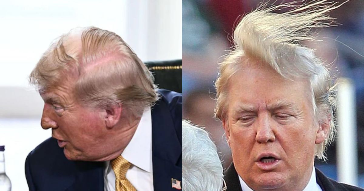 Trump’s Receding Hairline Steals the Spotlight During UK State Visit ...
