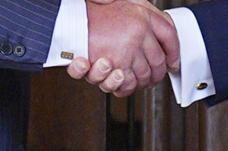 Doctor shares 'reason' for King Charles' 'sausage fingers' as he bids ...