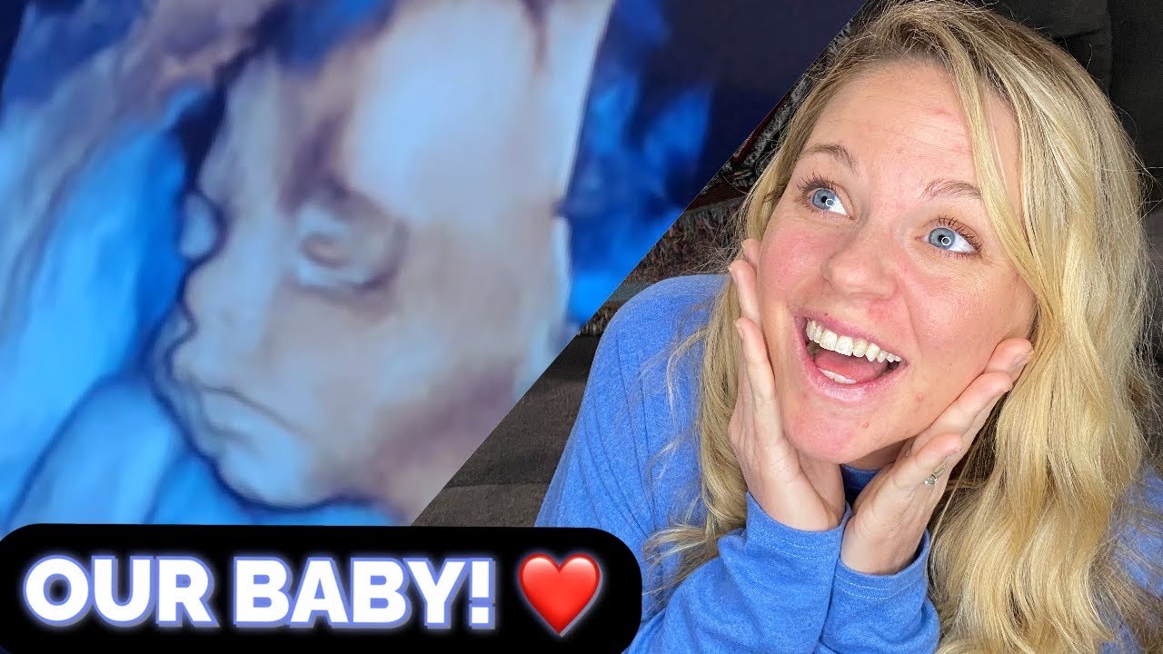 Parents See Baby’s Face for the First Time on Ultrasound