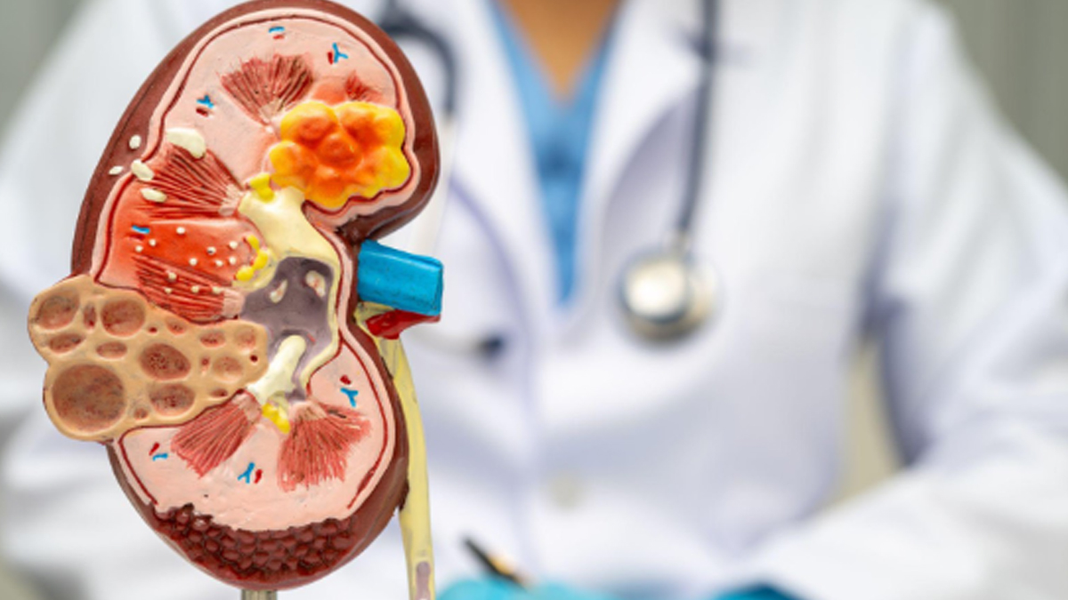 Are Your Daily Habits Slowly Damaging Your Kidneys? What to Change Now