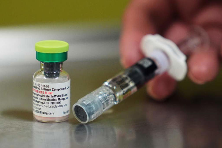 Potential measles exposure reported in and around Toronto as part of ...