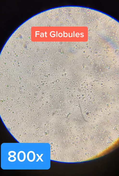 What’s Hiding in Your Milk? Shocking Microscopic View