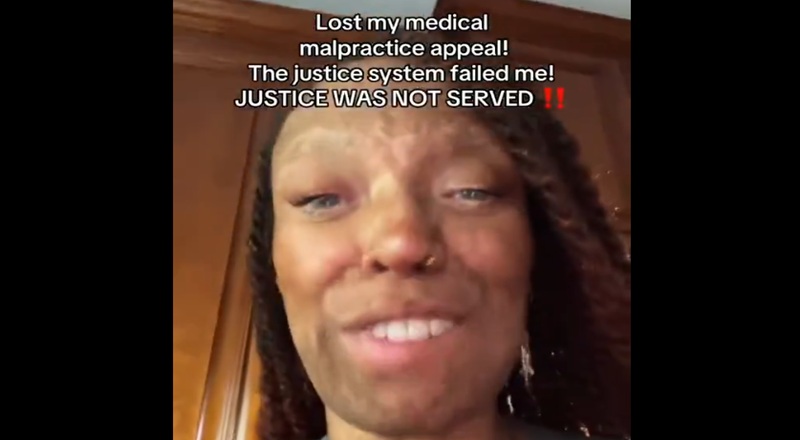 Khaliah Shaw says justice failed after her face “melted off” from ...