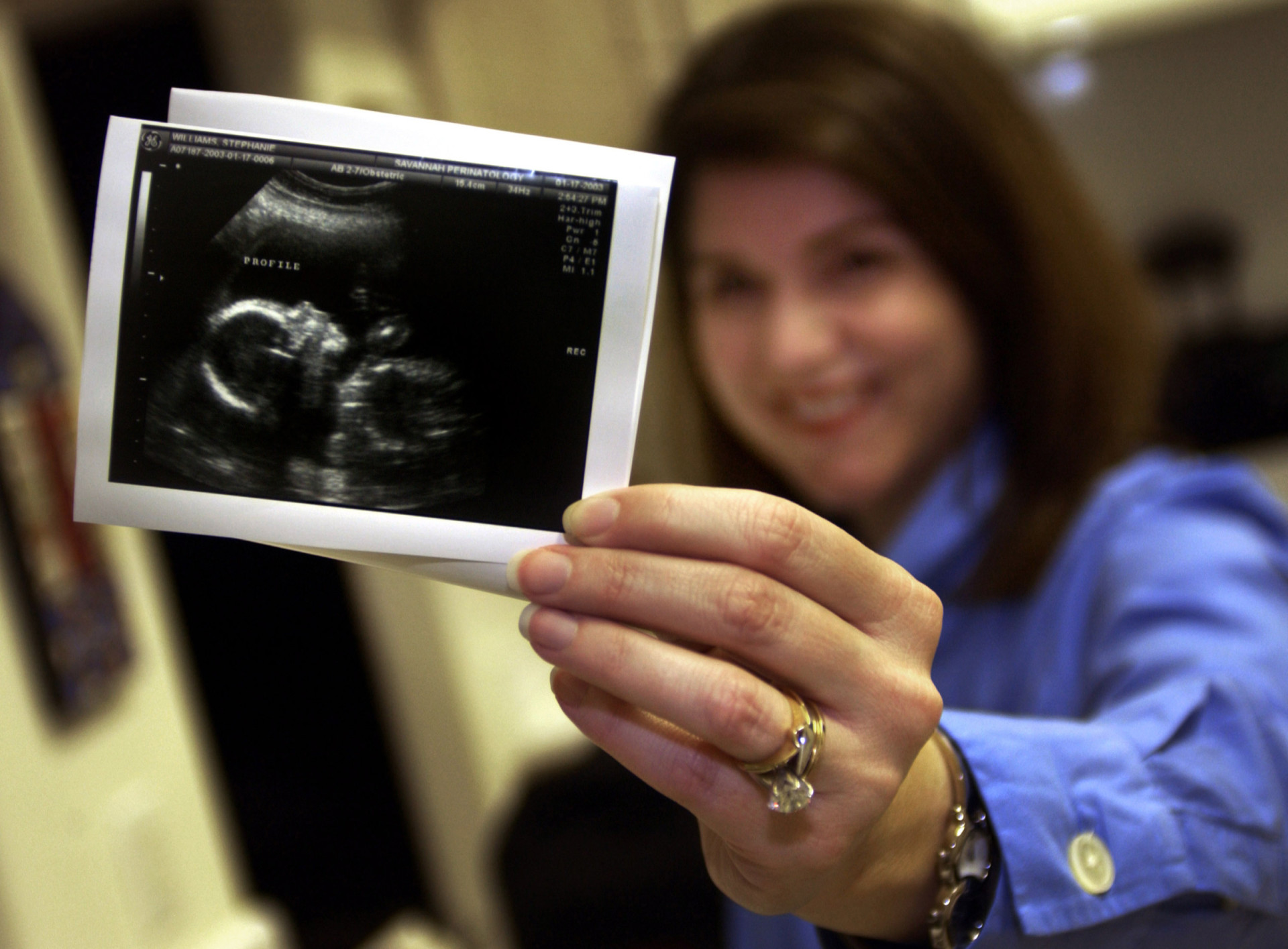 Framtidens fertilitet: fördelarna, nackdelarna och framstegen inom IVF