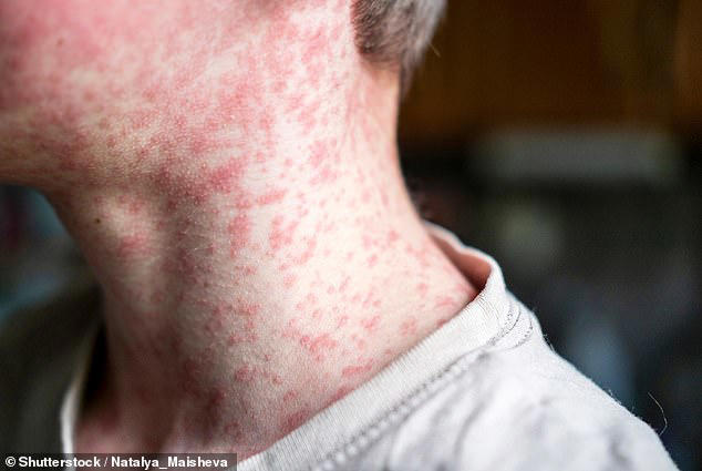 As NHS rolls out new 4-in-1 vaccine for babies - US health chiefs DITCH ...