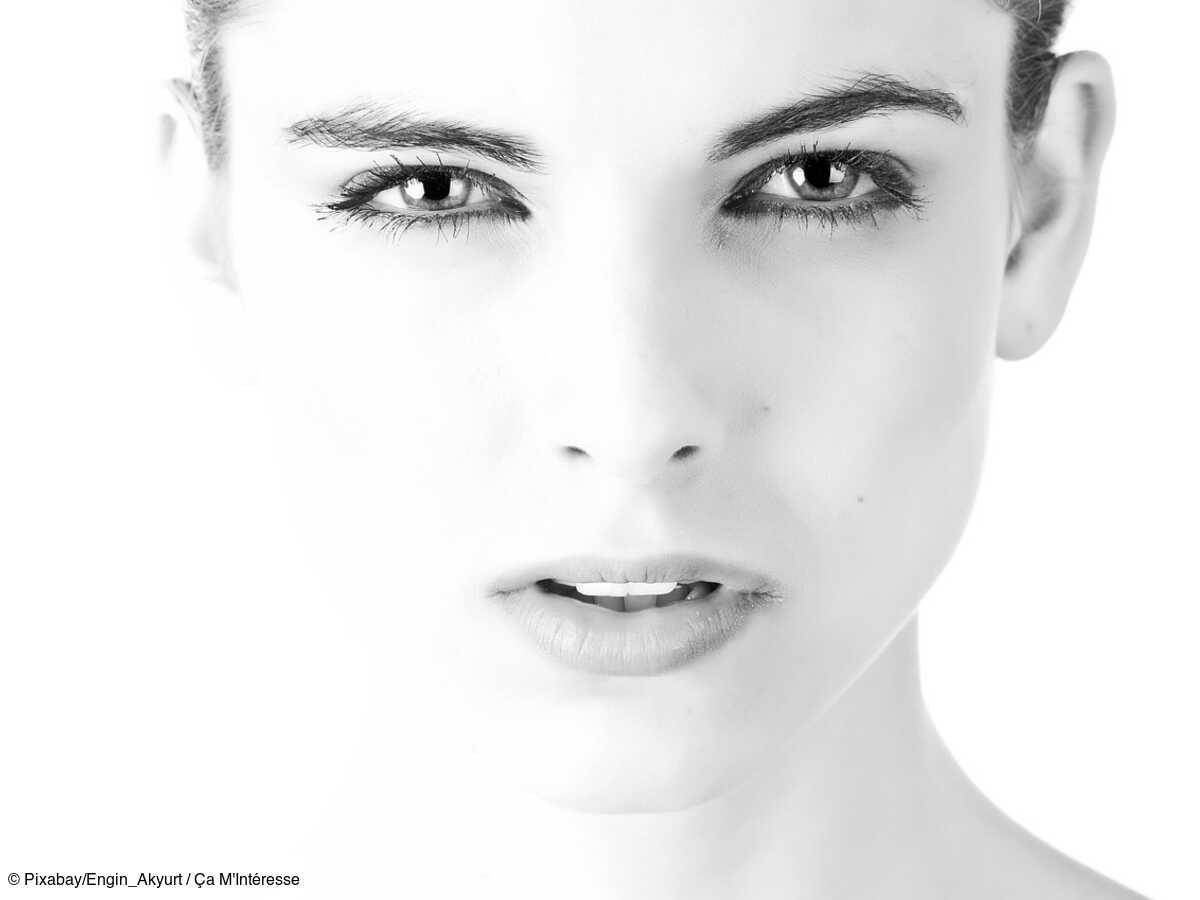 Grains de milium sur le visage : qu’est-ce que c’est et peut-on les ...