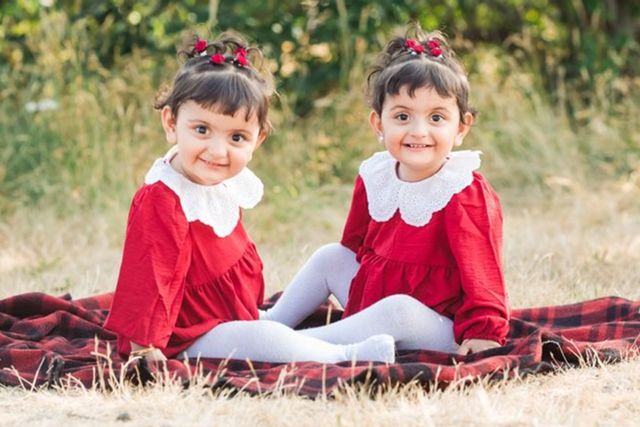 Rare Conjoined Twins Successfully Separated After 18-Hour Surgery That ...