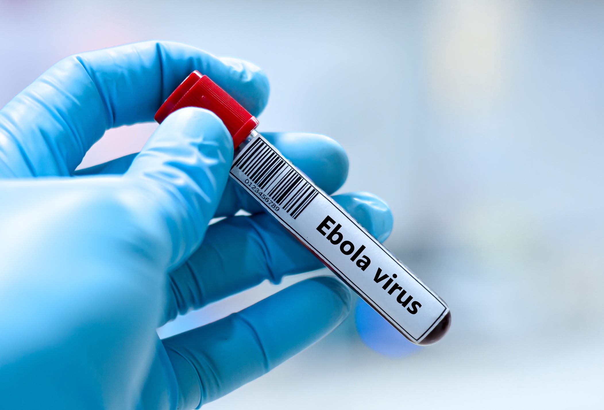 What is Ebola? CDC warns of virus outbreak. Risk low in Florida, US but ...
