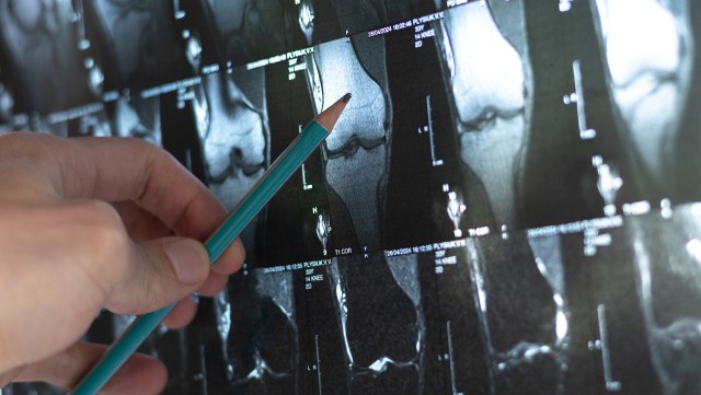 Scientists sound alarm after making unsettling discovery deep in human ...