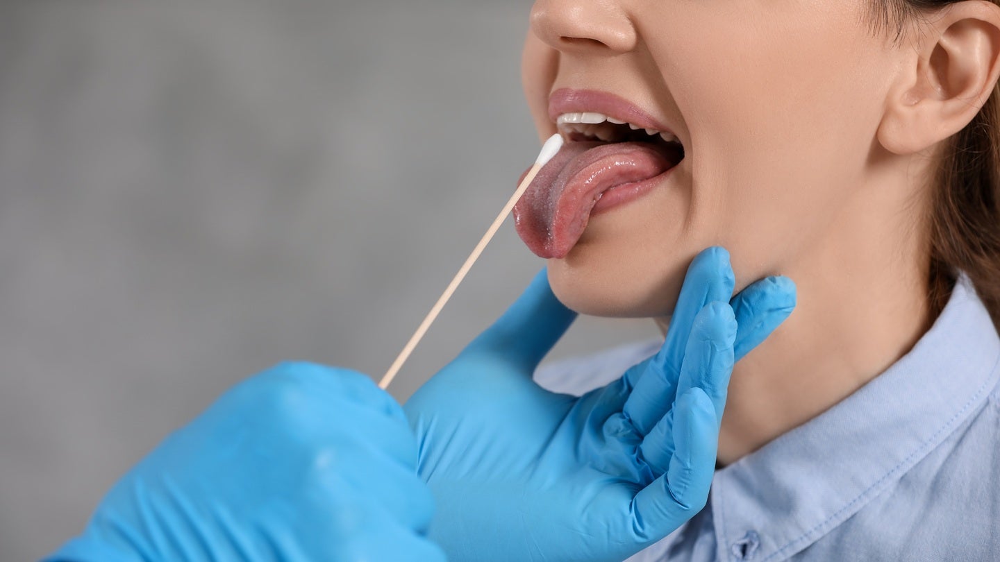 Tulane University develops CRISPR-based TB test using tongue swab