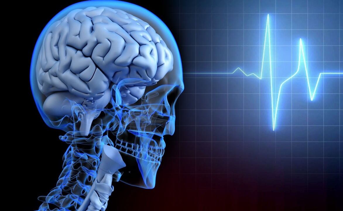 Keeping your brain safe starts with knowing about concussions