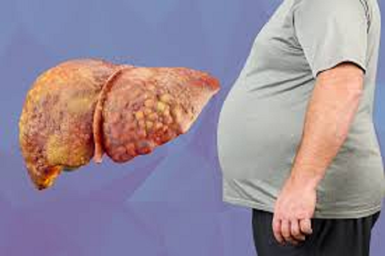 Improve Fatty Liver: If you start taking these 5 supplements, your ...