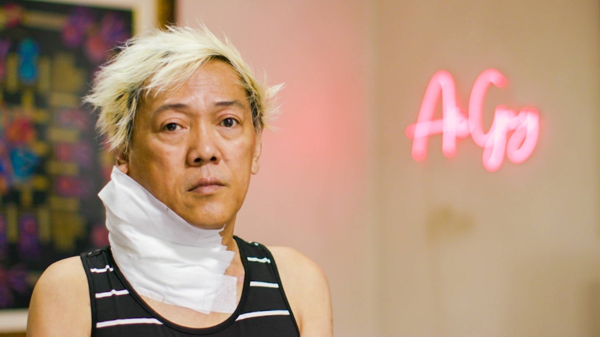 Comedian Ate Gay says he has stage-4 cancer, seeks prayers