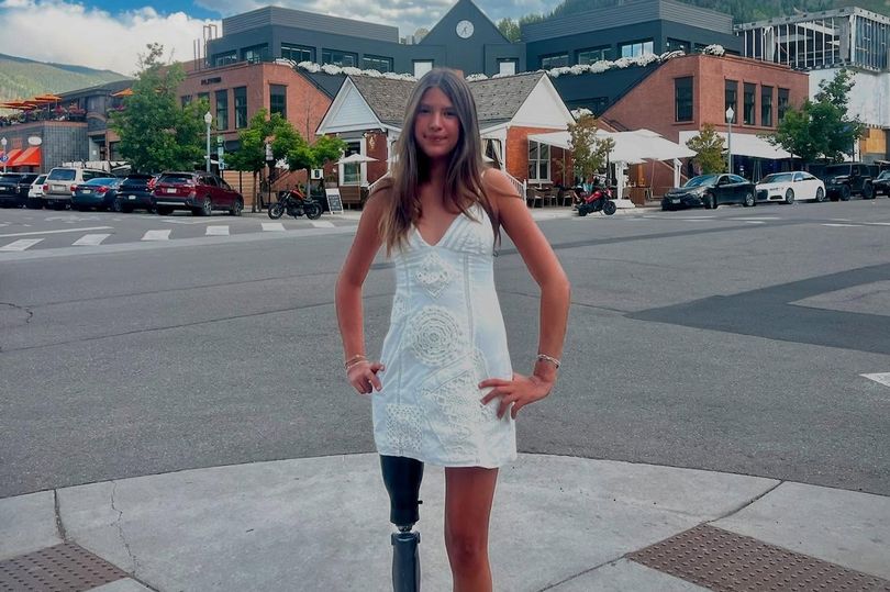 Teen loses leg after horror double shark attack during dream scuba ...