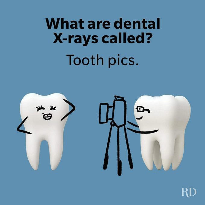 56 Dentist Jokes You Can Sink Your Teeth Into