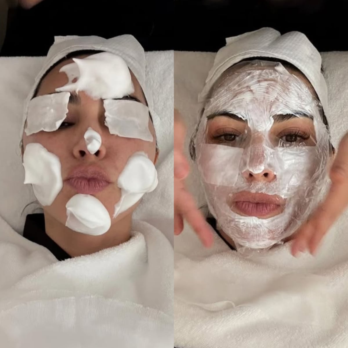 K-injections and K-lifting draw global medical tourists