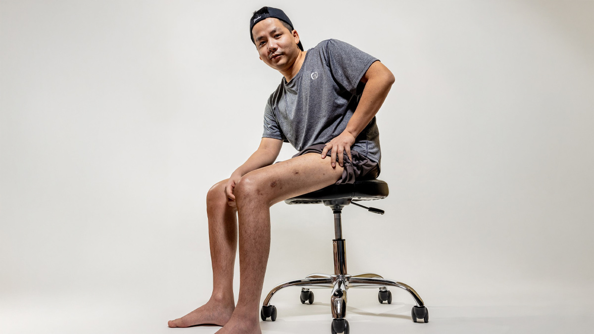 Would You Break Your Legs to Stand Taller? Exploring The Leg ...