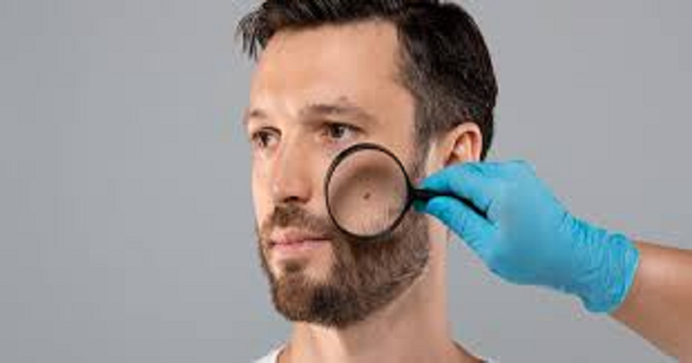 Why do white people get more skin cancer? So many cases are reported ...